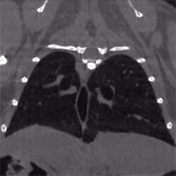 Mediso nanoScan PET/CT - Research Institute of the McGill University ...